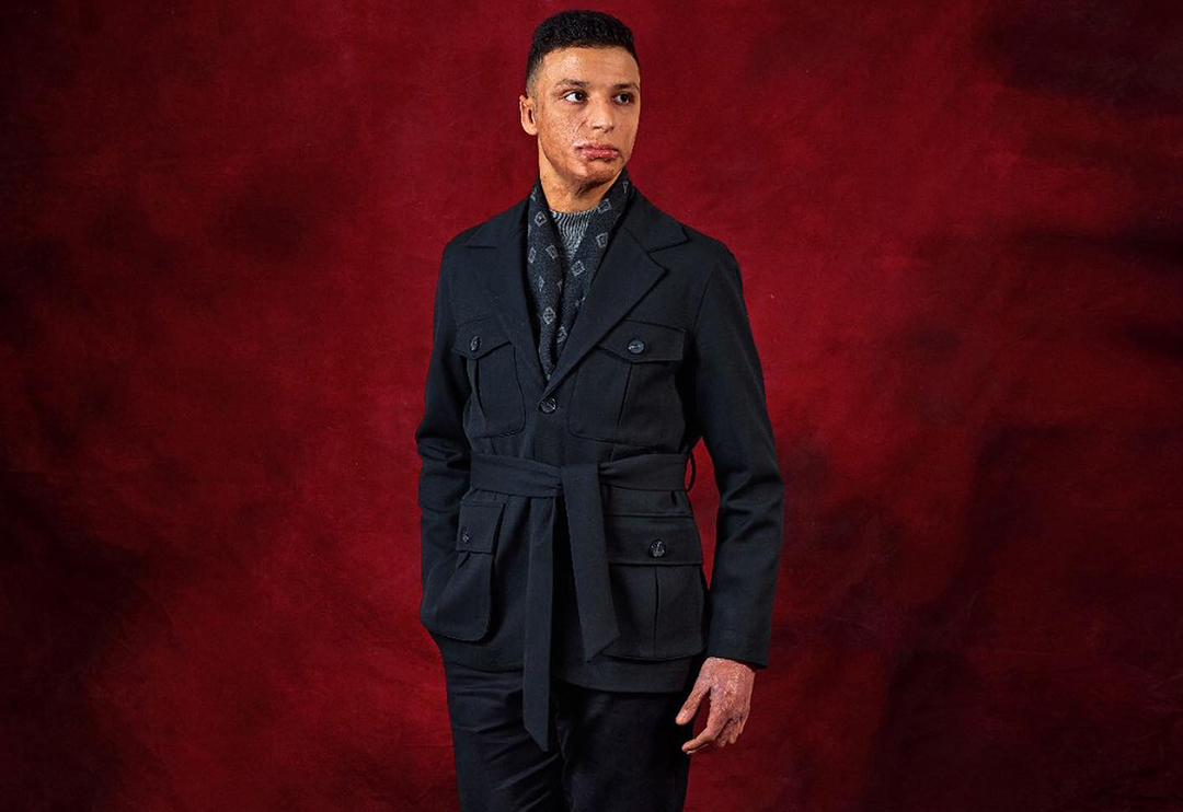 ZIAD TAREK BECOMES THE FIRST EGYPTIAN BURN SURVIVOR MODEL - TheDose-Mag
